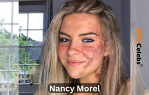 Who is Nancy Morel? Wiki, Age, Height, Parents, Skin Condition, Net ...